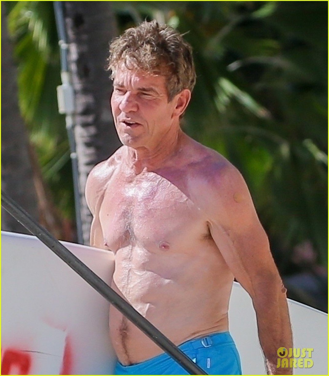 Dennis Quaid, 65, & New Fiancee Laura Savoie, 26, Show Off Ripped ...